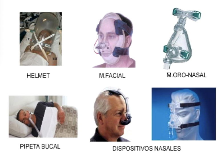 Importancia de interfaces en ventilación mecánica no invasiva (VMNI)
